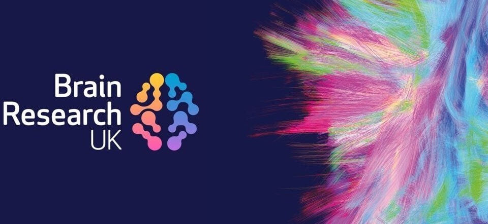 Brain Research UK: James's page