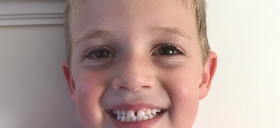 Epilepsy Society: Phillip Dean